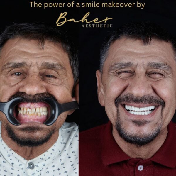 Baher - THE LATEST TECHNOLOGY IN DENTISTRY NOW AVAILABLE IN EGYPT